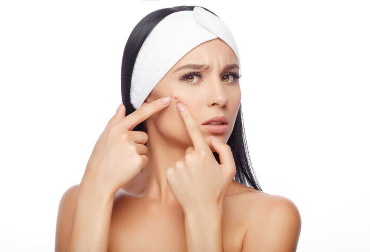 Mengatasi Jerawat dan Komedo