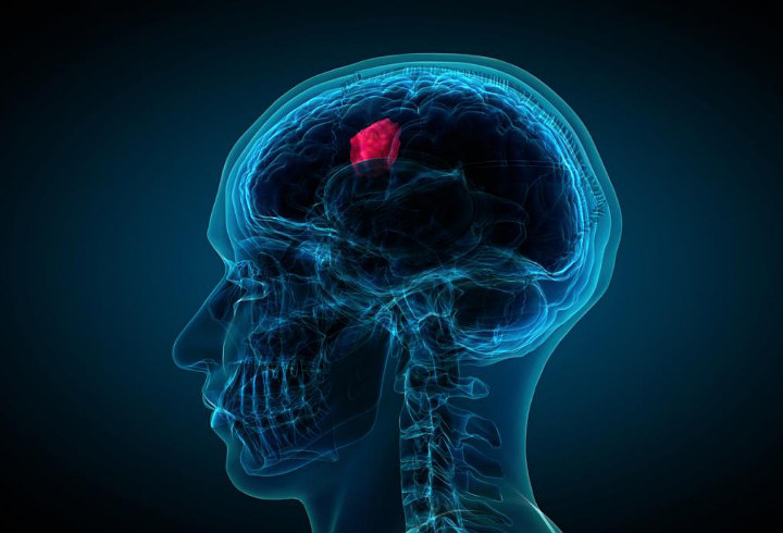 Tanda Radang, Cedera dan Tumor Sistem Saraf Pusat