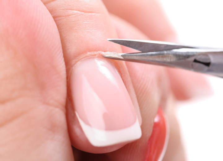 Memotong Kutikula