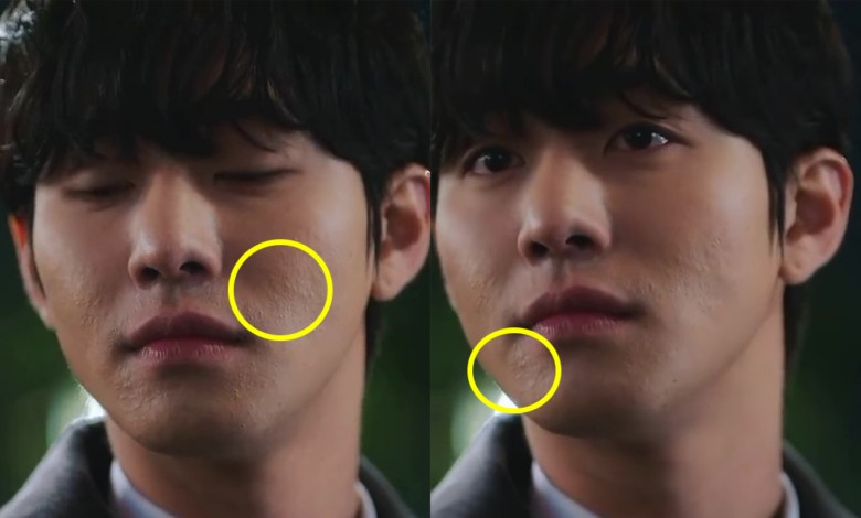 CEO Kang Tae Mo Juga Manusia, Wajah Berjerawat Ahn Hyo Seop di ...