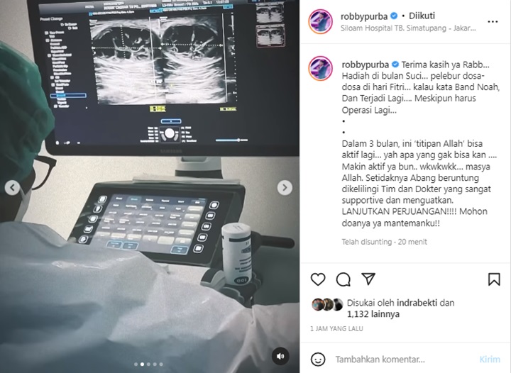 Tumor Di Payudara Kembali Tumbuh, Robby Purba Sebut Hadiah Bulan Ramadan