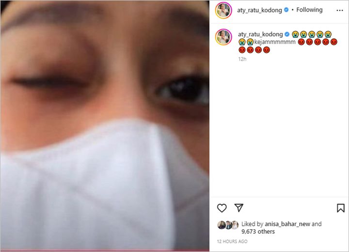 Dulu Tak Diundang Nikah, Aty Kodong Nangis Semangati Lesti Kejora ...
