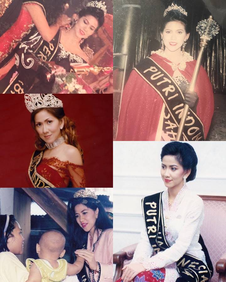 12 Transformasi Venna Melinda, Puteri Indonesia 1994 Hingga Diduga ...