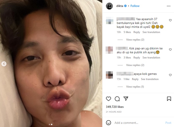 Ultah ke-37, Dikta Pamer Foto Bare Face Sambil Manyun Digoda Mirip Bayi
