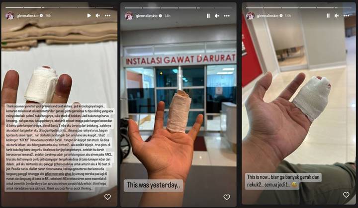 Glenn Alinskie Beber Kronologi Ngilu Jarinya Terjepit Pintu Garasi, Chelsea Olivia Sampai Lemas