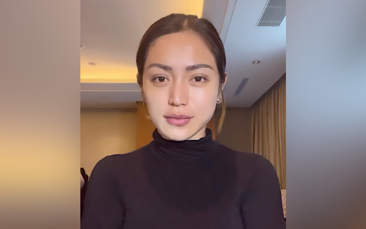 Jessica Iskandar Berasa Mirip Unnie Korea Saat Pandangi Wajah Sehabis Oplas