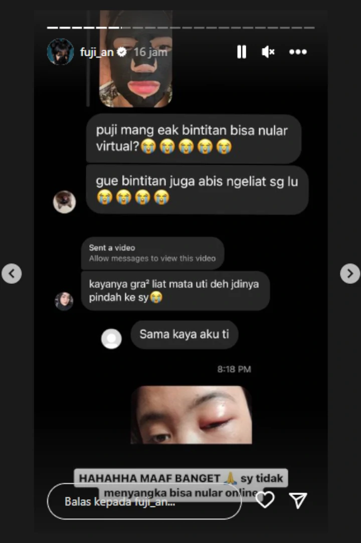 Dapat Banyak DM, Fuji An Kaget Disebut Tularkan Penyakit ke Fans