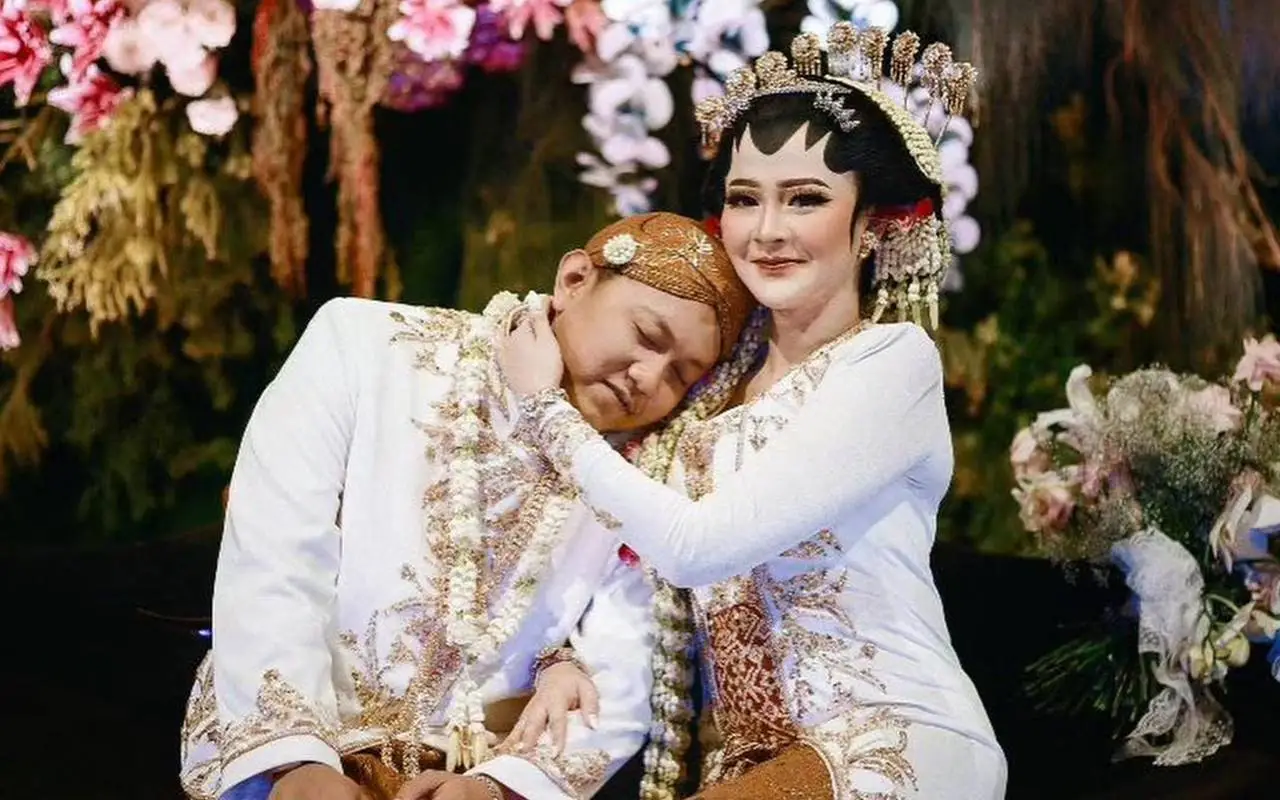 Dituding Oplas, Visual Bella Bonita Istri Denny Caknan Before-After ...