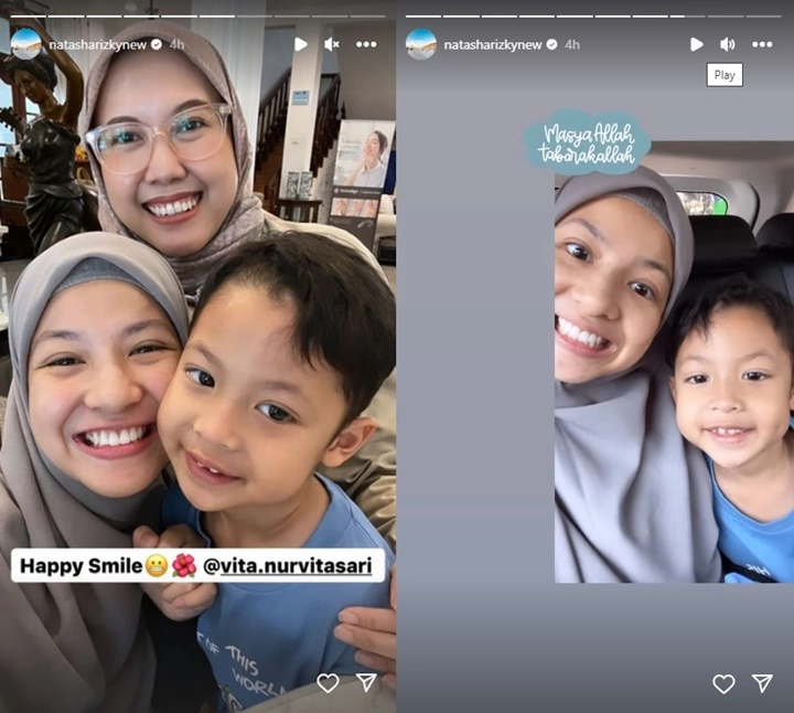 Natasha Rizki Dipuji Makin Cantik Tampil dengan Gigi Baru