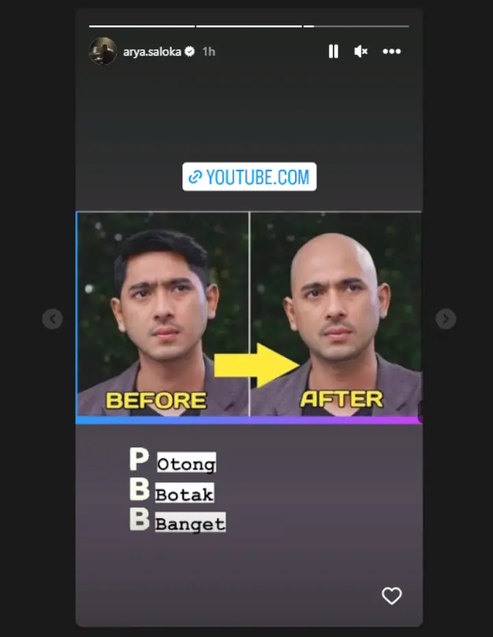 Penampilan Arya Saloka Botak Sukses Bikin Syok