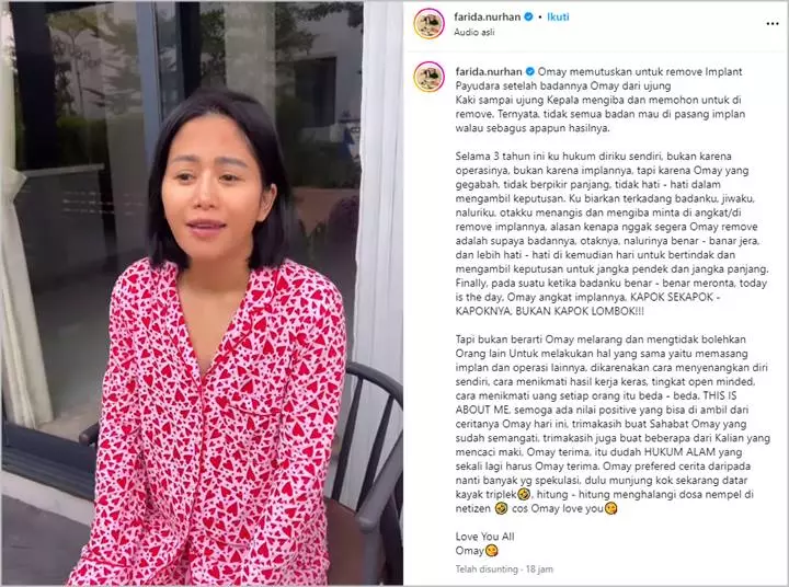 Farida Nurhan 'Omay' Jalani Operasi Angkat Implan Payudara, Sebut Hukum Diri Sendiri Selama 3 Tahun
