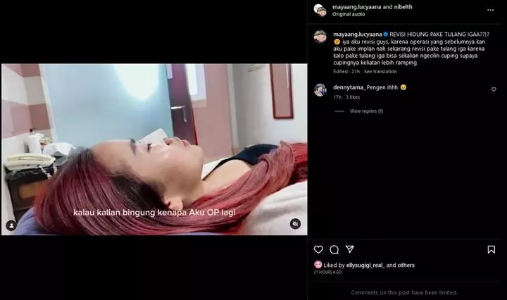 Mayang Adik Vanessa Angel Oplas Lagi, Penampilan Terkini Buat Ngilu