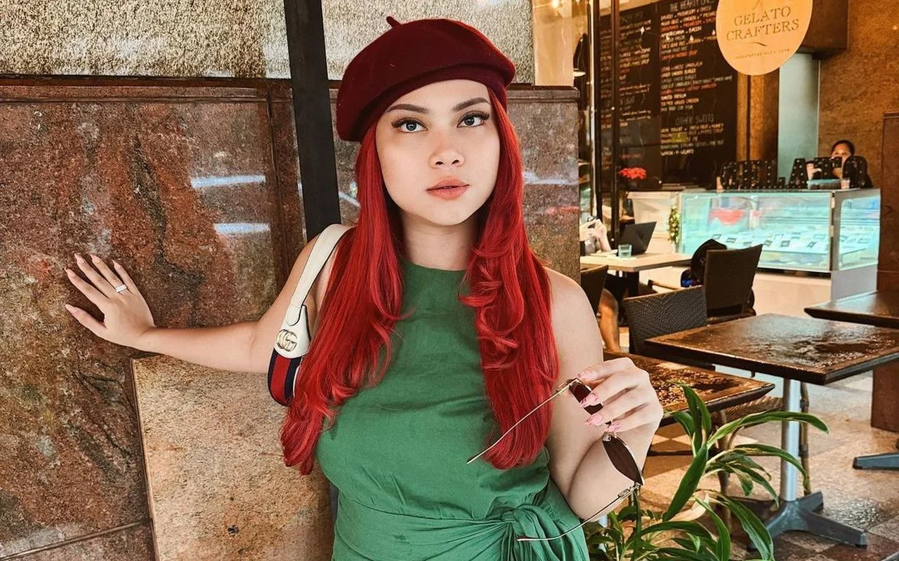 Hanum Mega Umbar Foto Lebam usai Bongkar Aib Ayah Kandung