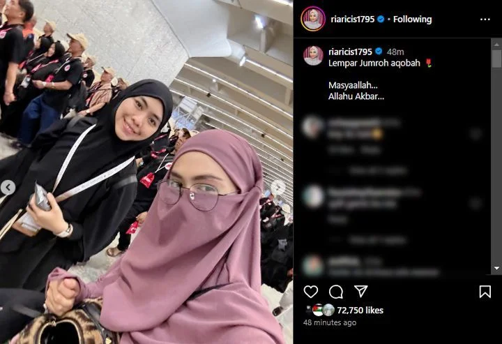 Ria Ricis Buat Khawatir karena Penampakan Memar di Wajah