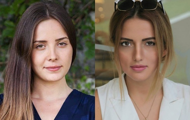 Pose Cantik, Selin Sezgin dan Esin Benin 'Elif' Dituduh Operasi Plastik