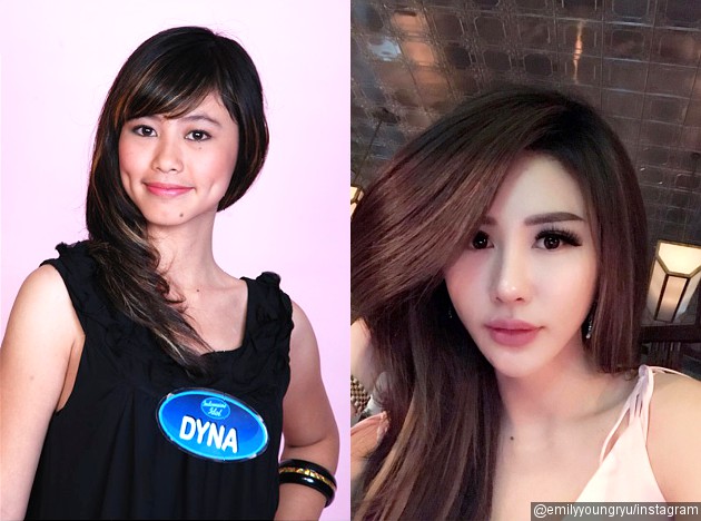 Cantik Ala Artis Korea dan Ganti Nama, Foto Lawas Dyna Fransisca 'Idol ...
