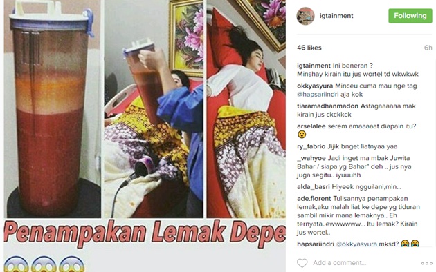 Habiskan Ratusan Juta, Sebanyak Inikah Hasil Operasi Sedot Lemak Dewi ...