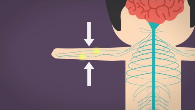 Suka Ngerasa Kesemutan, 5 Info Penting Banget Ini Nggak Bisa Kamu ...
