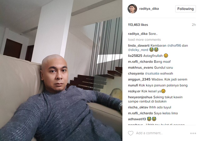 Raditya Pamer Kepala Pelontos, Netizen Samakan dengan Bakso hingga Tuyul